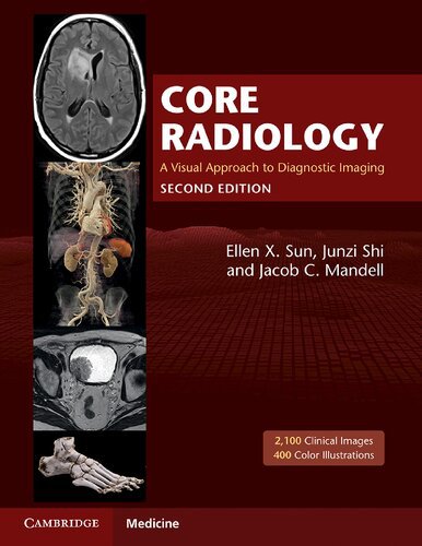 کتاب کور رادیولوژی Core Radiology: A Visual Approach to Diagnostic ...